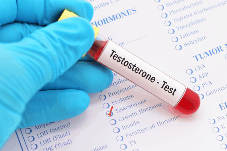 Testosterone - Liều lượng & Cách dùng thuốc an toàn
